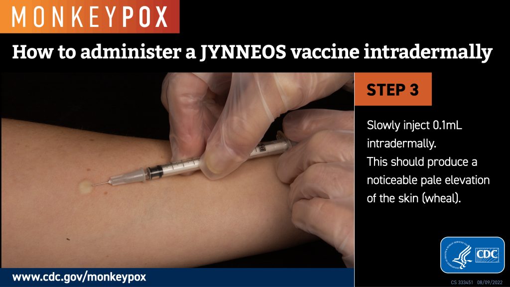 MPOX (Monkeypox) Vaccine - Licking County Health Department